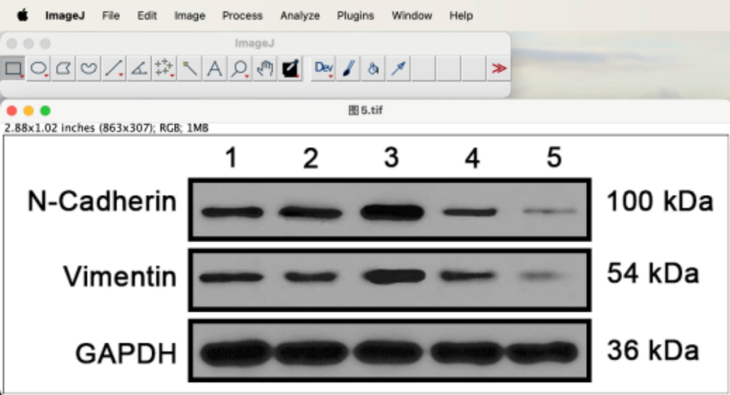一种用于WB实验结果识别及统计学分析便捷方法_条带_蛋白_灰度