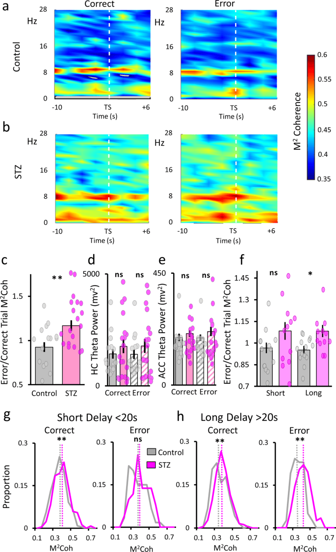 Intan RHD 2000海马区对工作记忆功能至关重要_变化_tau_模型